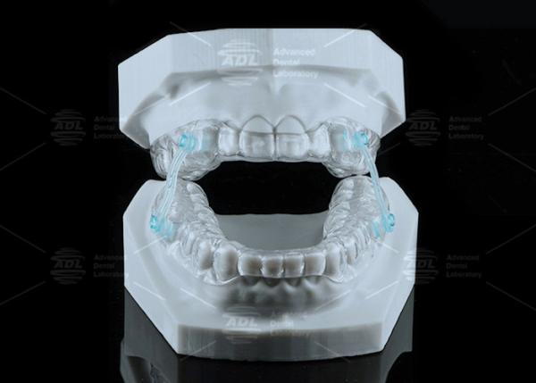 Quality Transparent Erkodent Silensor Anti Snoring Mouthpiece Custom Fit Noise Reduction for sale