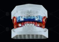 Quality Medical Grade Silicone Anti Snoring Appliance RP For Improved Sleep manufacturer