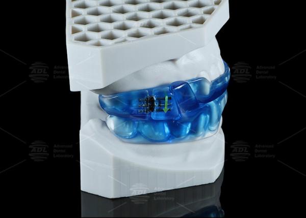 Quality Customizable Dorsal Sleep Appliance Anti Snoring Device For Restful Sleep for sale