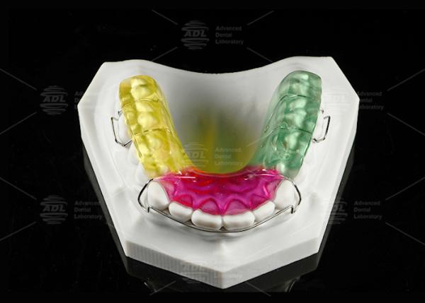 Quality Acrylic Twin Block Orthodontic Appliance For Correcting Malocclusion for sale