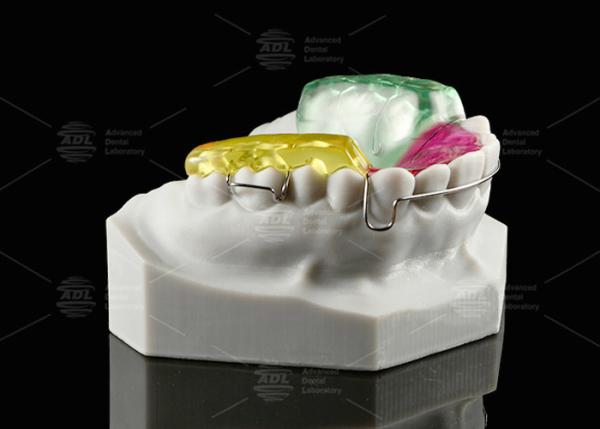 Quality Acrylic Twin Block Orthodontic Appliance For Correcting Malocclusion for sale
