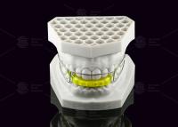 Quality Acrylic Orthodontic Bionator Appliance Corrects Class II Malocclusion manufacturer