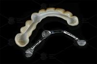 Quality Customizable Reinforcement Titanium Bar Combined with Milled Zirconia providing for sale