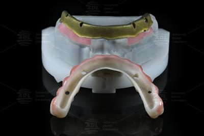China China Dental Lab Compatible With Most Dental Implant Systems All on 4 Offering In 72 Hours Turnaround Time And Array Technical Parameters for sale