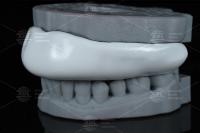 Quality Convenient Occlusal Sport Guard Bite Splint Design Easy To Clean Comfortable for sale