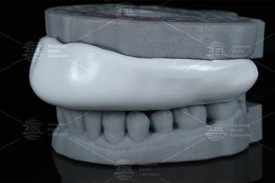 China Convenient Occlusal Sport Guard Bite Splint Design Easy To Clean Comfortable Protective Device For Teeth Grinding for sale