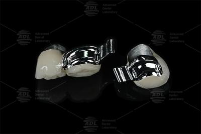 China China Dental Lab Adjustable Patient Specific Keyway Precision Attachment with PFM for sale