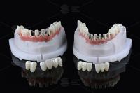 Quality China Dental Lab Titanium Full Arch Hybrid Bridge with Immediate Loading A1 for sale