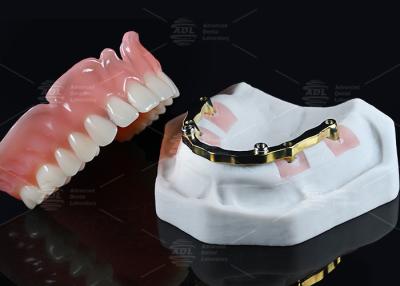 China China Dental Lab Titanium Locator Attachment with full acrylic over denture for sale