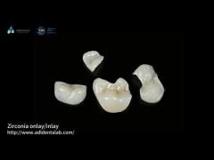 Infisso di zirconia trasparente per una resistenza all‘usura e alle macchie duratura