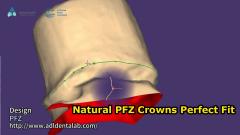 PFZ Dental Crowns Natural Strength and Precision Fit