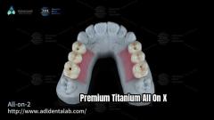 Premium Titanium Implant Bar for All On X Dentistry