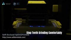 Custom 3D Printed Night Guard for Teeth Grinding Relief