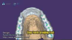 Best Nylon Night Guard for Teeth Grinding Relief