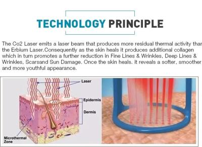 Cina Attrezzatura frazionaria del laser di CO2 facciale del corpo, attrezzatura medica di bellezza 10600nm in vendita