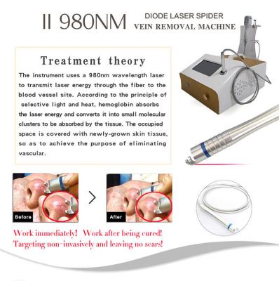 China Tratamento 980nm do fungo do prego refrigerar de ar da máquina da remoção da veia da aranha do laser do diodo à venda