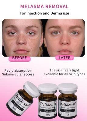 Cina Stalidearm Riempitivi cutanei Migliorano l'aspetto delle lentiggini Cura della pelle del viso Trattamento del melasma in vendita