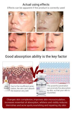 China derma Meso Serum Microneedling 10ml Brightening Caviar Anti Aging Serum for sale