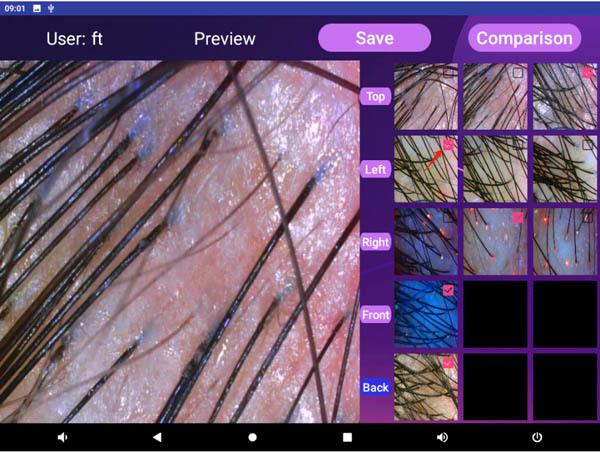Hair analyzer in professional salon setting
