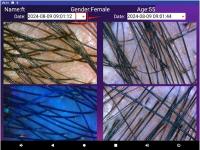 China SICAPU SCP-258 Hair Analyzer Machine with 18.5 Inch HD Screen, 200x Magnification and 32GB Storage for sale