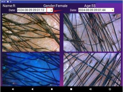 China AI Hair Testing Machine High Precision Detection For Hair And Scalp Examination for sale