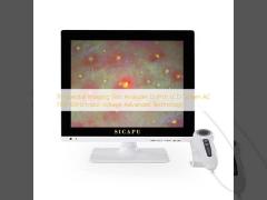 Tri-spectral Imaging Skin Analyzer 15 Inch LCD Screen AC 110V 60Hz Input Voltage Advanced Technology