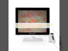 Commercial 15 Inches Tri-spectral Imaging Skin Analyzer: Reliable Results for Skin Care Consultations
