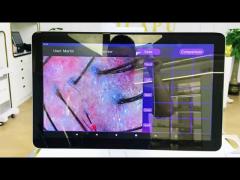 AC 110V / 220V AI Hair Analysis Testing Machine With Software 32G Hard Disk