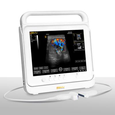 China PT50 hand-carried portable ultrasound machine color doppler for pregnancy for sale