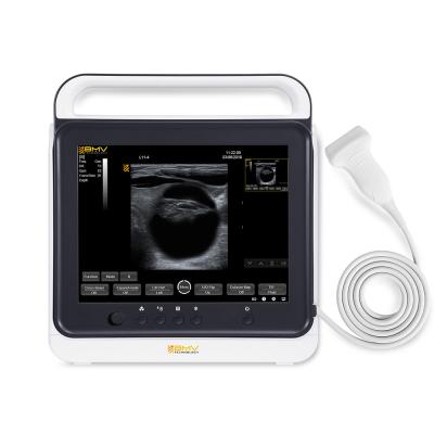 China PT50A Pad Touch Medical Ultrasound scanner System with 3 Probe Ports 15 inch screen for sale