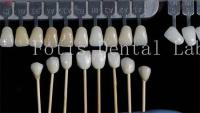Quality Customization Natural Dental Veneers Fake Teeth Overlays High Strength for sale