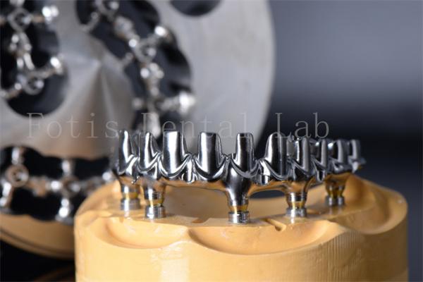 Quality Minimally Invasive Restore Chewing All On 4 All On 6 Titanium Or Zirconia Teeth for sale