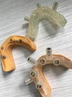 China Dental Lab Implant Crowns High Strength Zirconia Ceramic Custom Shade Matching CAD CAM for sale