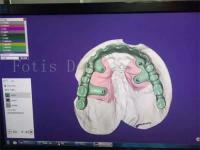 China Dental Design Teeth Layout Generator Tooth Blueprint Builder 3D Dental Prosthesis Software for sale