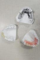 China Long Lasting Flexible Removable Partial Denture Easy Cleaning Replace Missing Teeth for sale