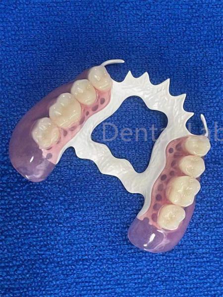 Stain Resistant Removable Dental Partials Stable Replace Missing Teeth Prosthesis