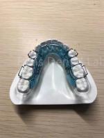 China Orthodontic Retainer Expander Adjustable Palatal Expander One Size Fits All for sale