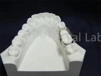 China Adjustable Orthodontic Retainer Expander One Size Fits All for Teeth Retention and Expansion for sale