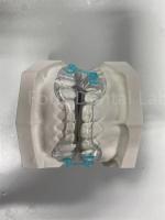 China Orthodontic Correction Device Medical Grade Stainless Steel Adjustable Teeth Alignment 20-22 Hours Wear for sale