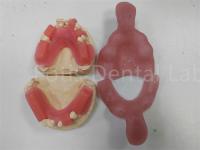 China Red Glossy Bite Rims for Upper or Lower Teeth Occluding Relation Lightweight for sale