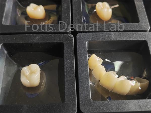 Quality Dental Restorations Zirconia Multilayer Fracture Resistance for sale