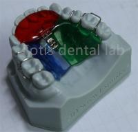 China Customizable Orthodontic Retainer Expander One Size Fits All for Teeth Retention for sale