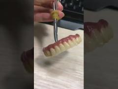 Zirconia All-on-4 임플란트 수술 같은 날 회복 최소한의 후속 치료가 필요합니다