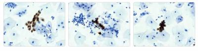 Cina Prova di dosagggio immunologico dello screening del cancro cervicale ICC Kit Staining Keypath P16 in vendita