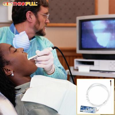 Cina Mini 3.3mm 1000P Oral Endoscope Camera Modulo Grande Angolo 140 Gradi in vendita