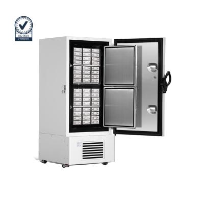 중국 시험소 병원은 마이너스 86 도와 340L 극단적 저온 냉동고를 PROMED 판매용