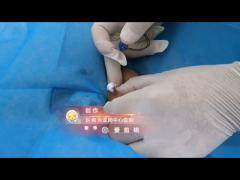 Phimose Retracteur chute pratique
