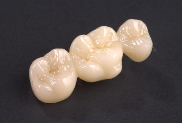 Quality Precise Fit Full Contour Zirconia Bridge Natural Zirconia Crown Bridge High Strength for sale