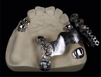 China Afneembare kunsttandtelescoop met composiet en metalen raam Te koop