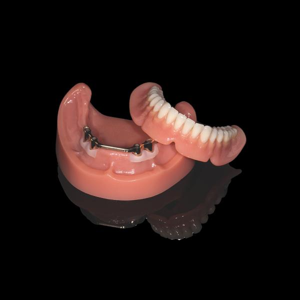 Quality Pink Titanium Bar Removable Dentures With Acrylic Denture Finish for sale